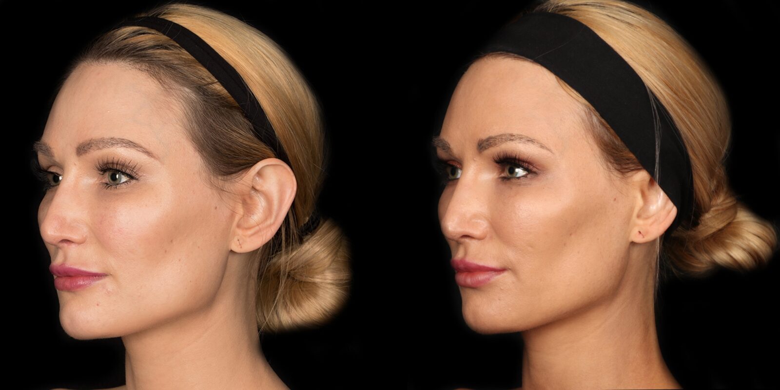 4 Best Spa Treatment for Face - Get Healthy Lifestyles