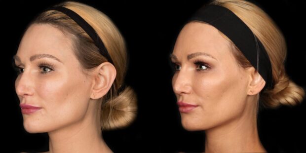 4 Best Spa Treatment for Face - Get Healthy Lifestyles